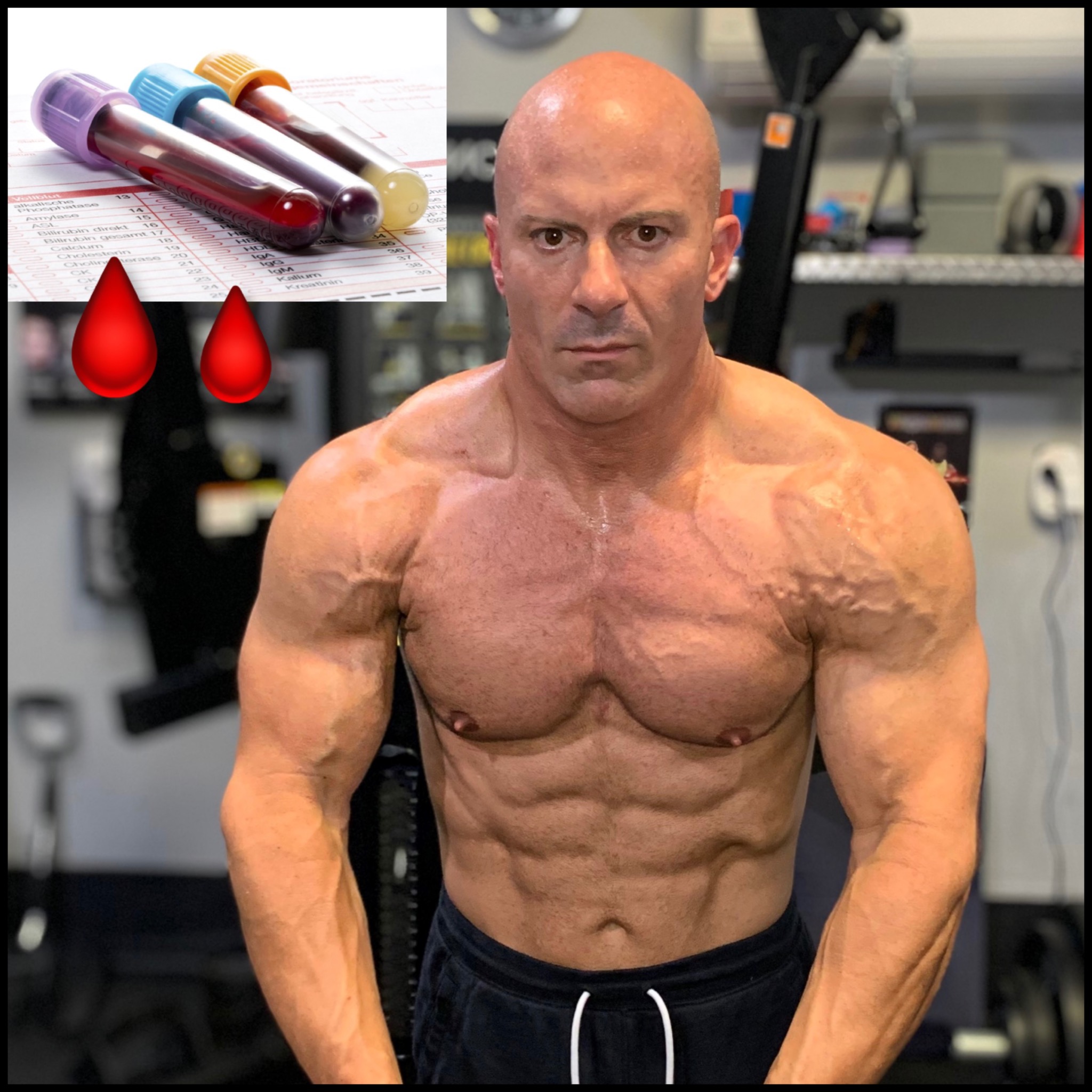 The ONE THING That Had The Biggest Impact on My Recent Bloodwork ...