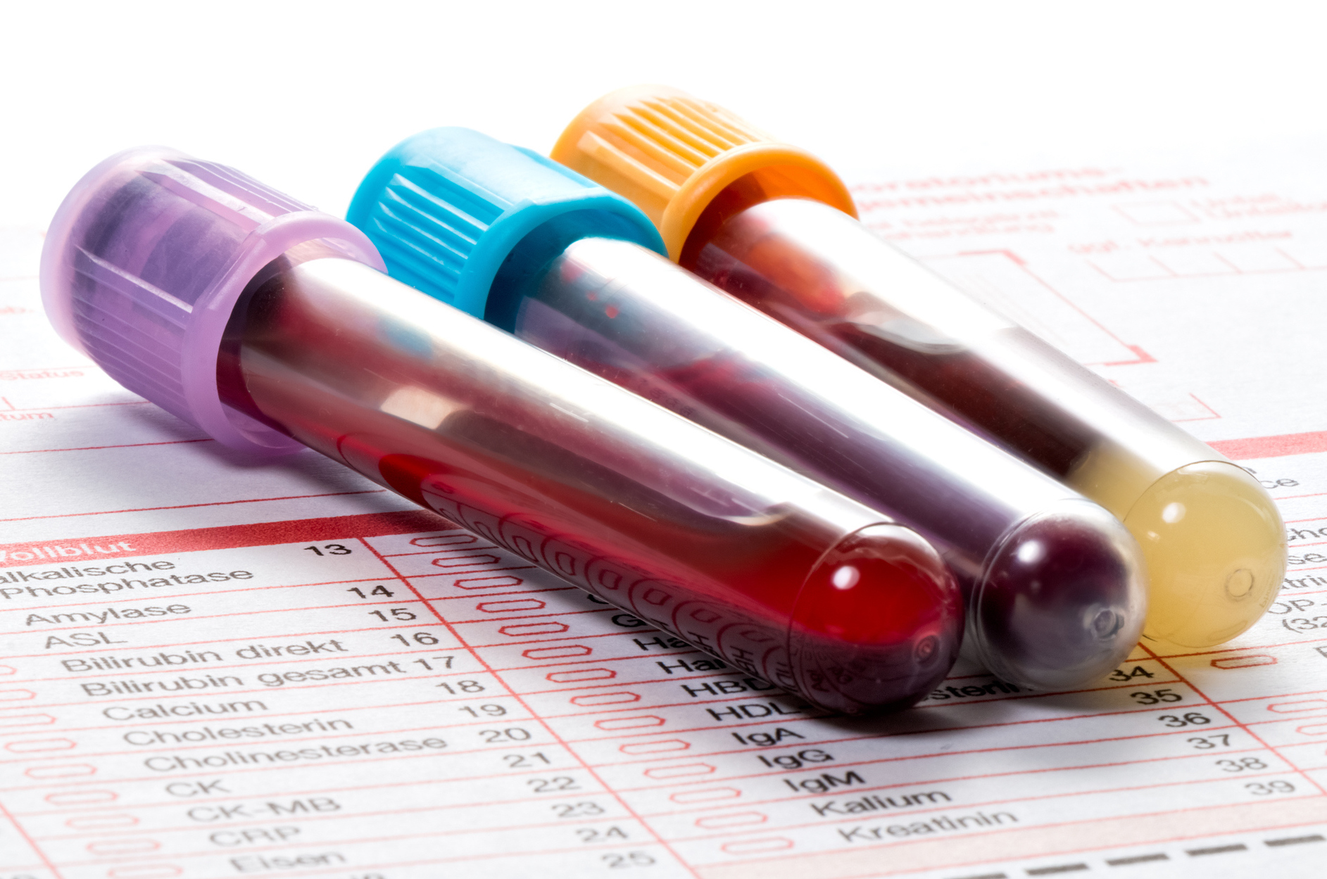 The 8 Blood Tests You MUST Monitor for Your Health & Longevity [w/ Dr ...